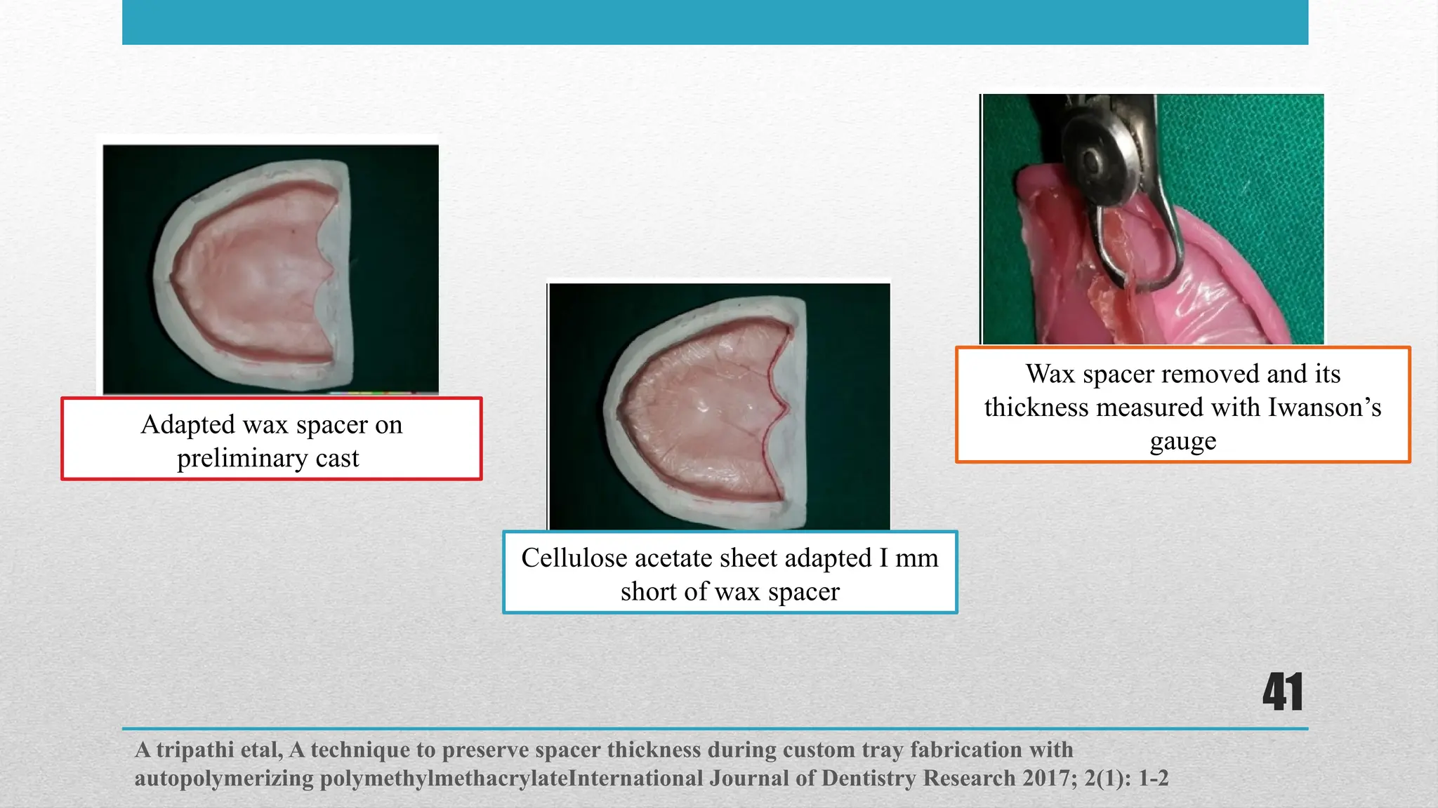 SPACER DESIGNS AND STOPPERS................ | PPTX