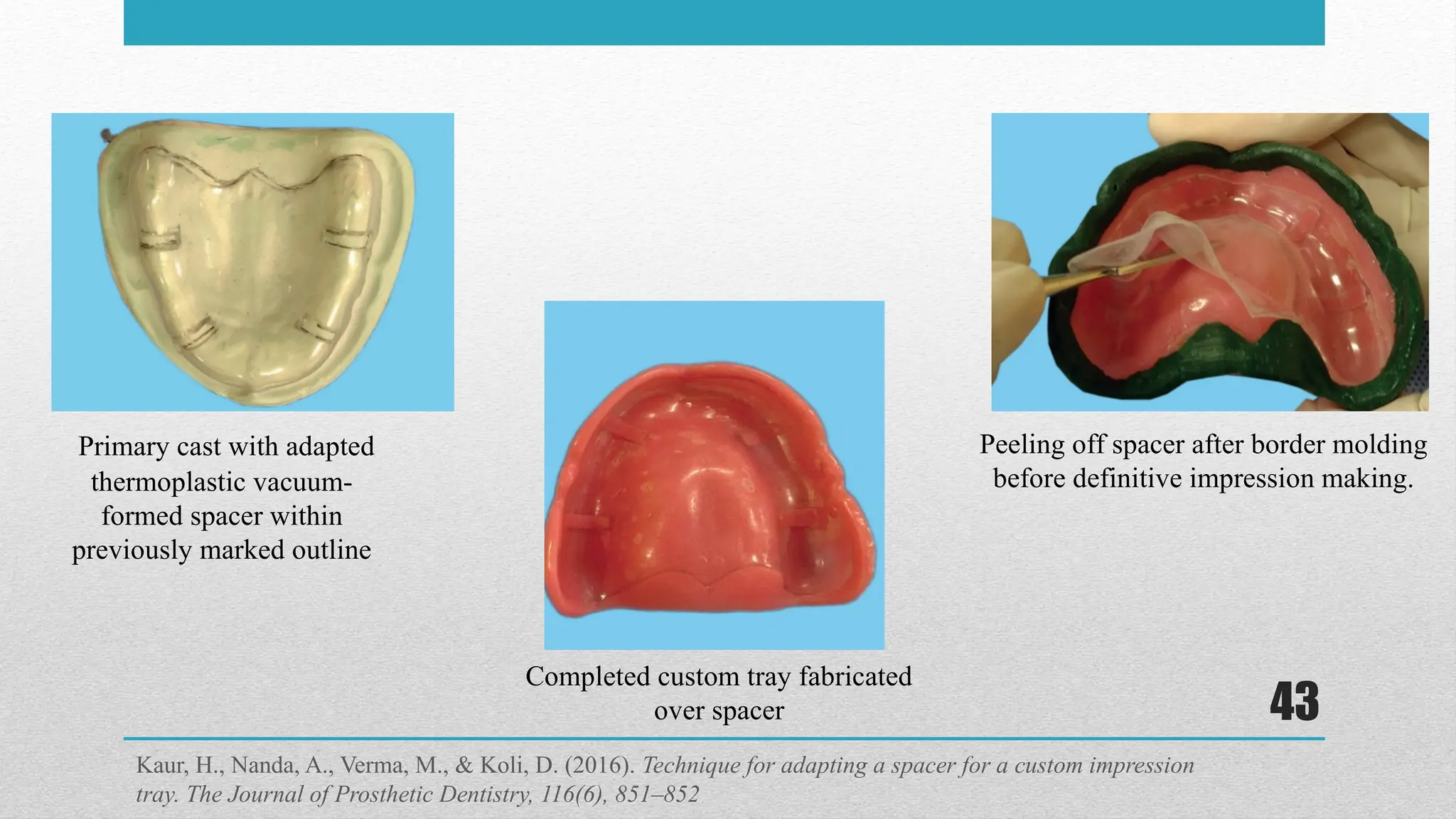 SPACER DESIGNS AND STOPPERS................ | PPTX