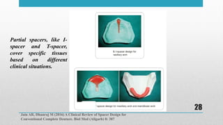 SPACER DESIGNS AND STOPPERS................ | PPTX