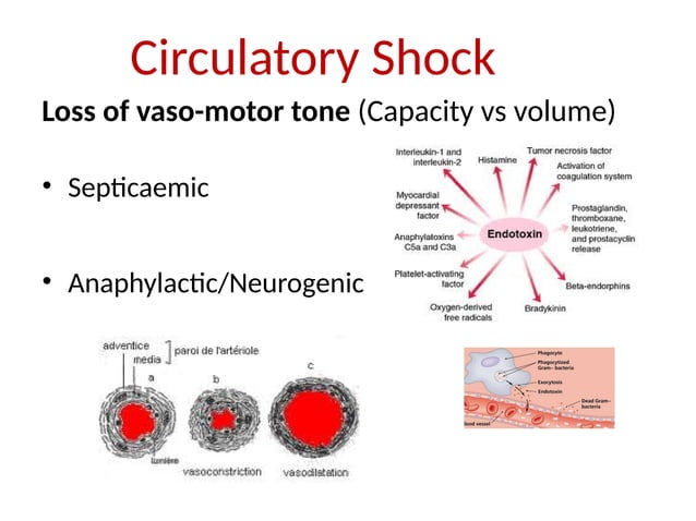 Circulatory Shock power point presentation | PPT