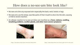 Invisible blood sucker: no-see-um (biting midge) | PPT