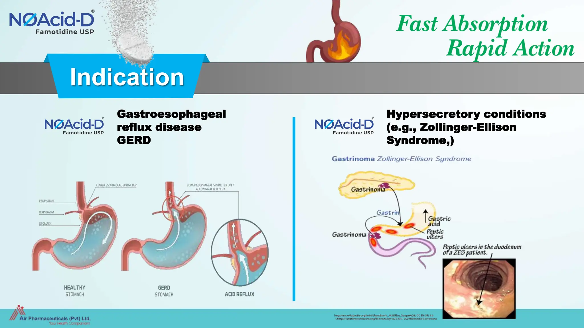 noacid-d Dispersible femotidine tab.pptx