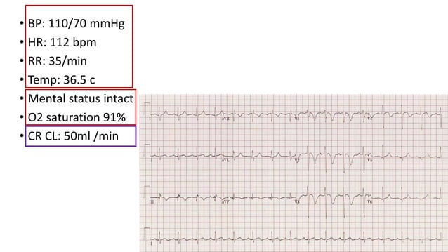 Noac in pulmonary embolism | PPT