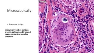 Short notes on restrictive lung disease brief histology | PPTX