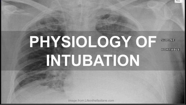 No apologies: intubation of the shocked patient | PPTX | First Aid ...