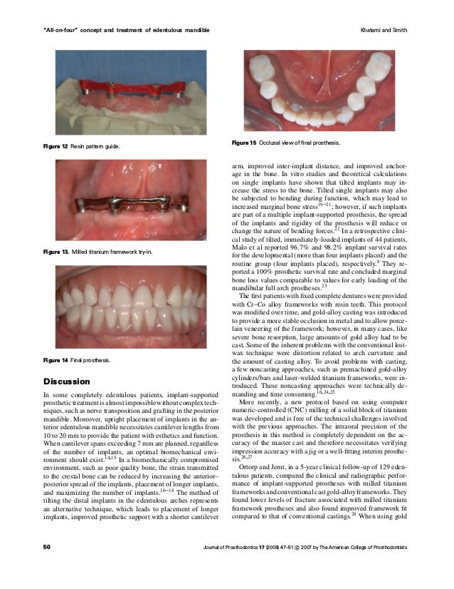 Nobel-Biocare-All-on-4-Restorative-Steps-Roadmap.pdf