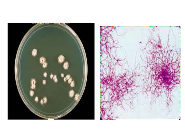 Nocardia | PPTX | Lung and Respiratory Health | Diseases and Conditions