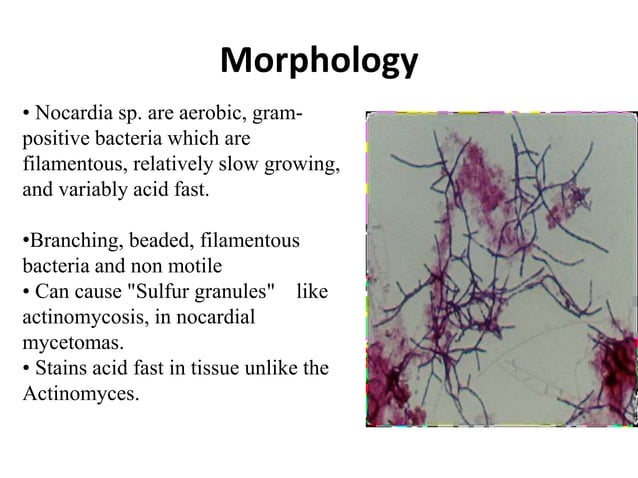Nocardia | PPTX | Lung and Respiratory Health | Diseases and Conditions