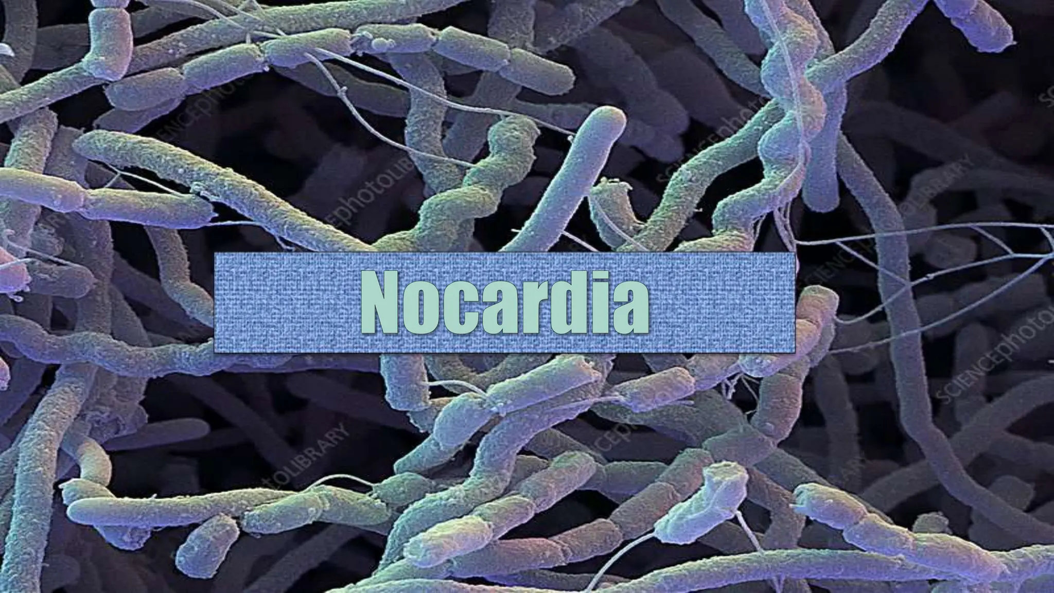 Nocardia.pptx | Infectious Diseases | Diseases and Conditions