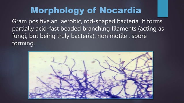 Nocardia.pptx | Infectious Diseases | Diseases and Conditions