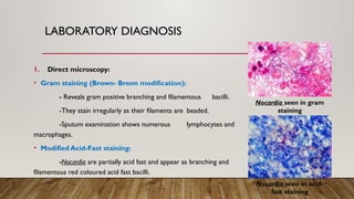 Nocardia.-Introduction,Morphology,Classification,Pathogenesis ...