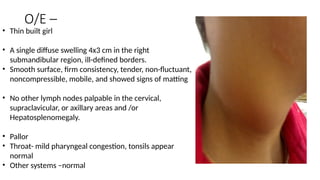 Nodal TB Diagnostics Modalities in children .pptx