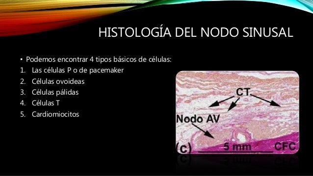 Nodo sinusal(keith y flack) como