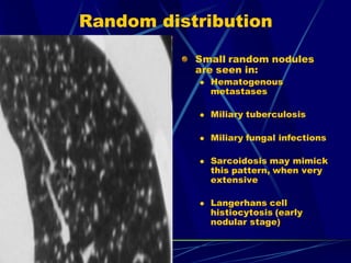Nodular pattern | PDF | Lung and Respiratory Health | Diseases and ...