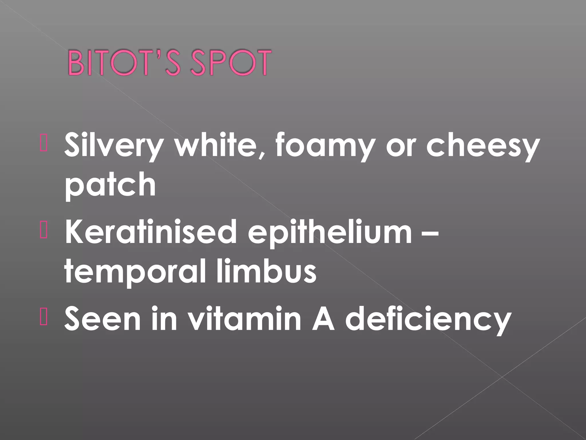 Nodule at the limbus | PPT
