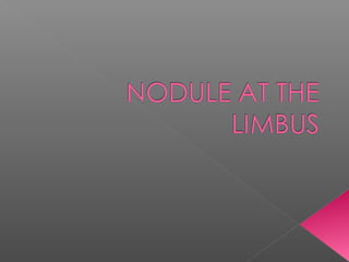Nodule at the limbus | PPT
