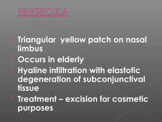 Nodule at the limbus | PPT