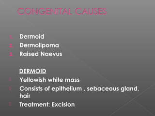 Nodule at the limbus | PPT