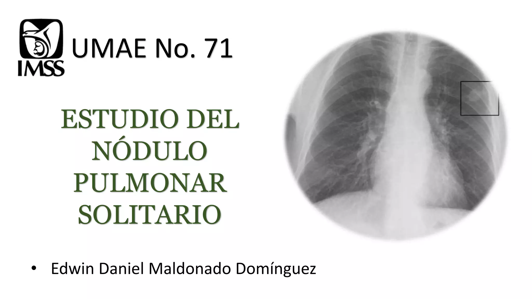 Estudio Del Nódulo Pulmonar Solitario | PPTX