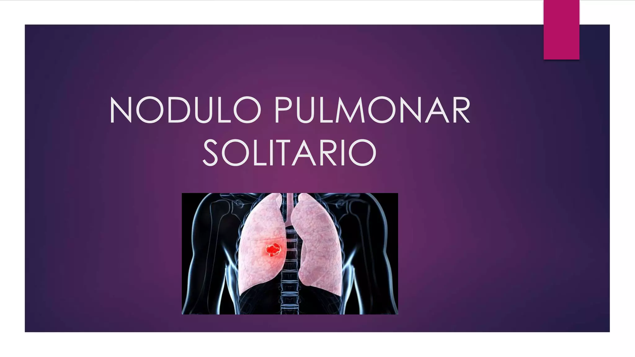 NODULO PULMONAR SOLITARIO.pptx