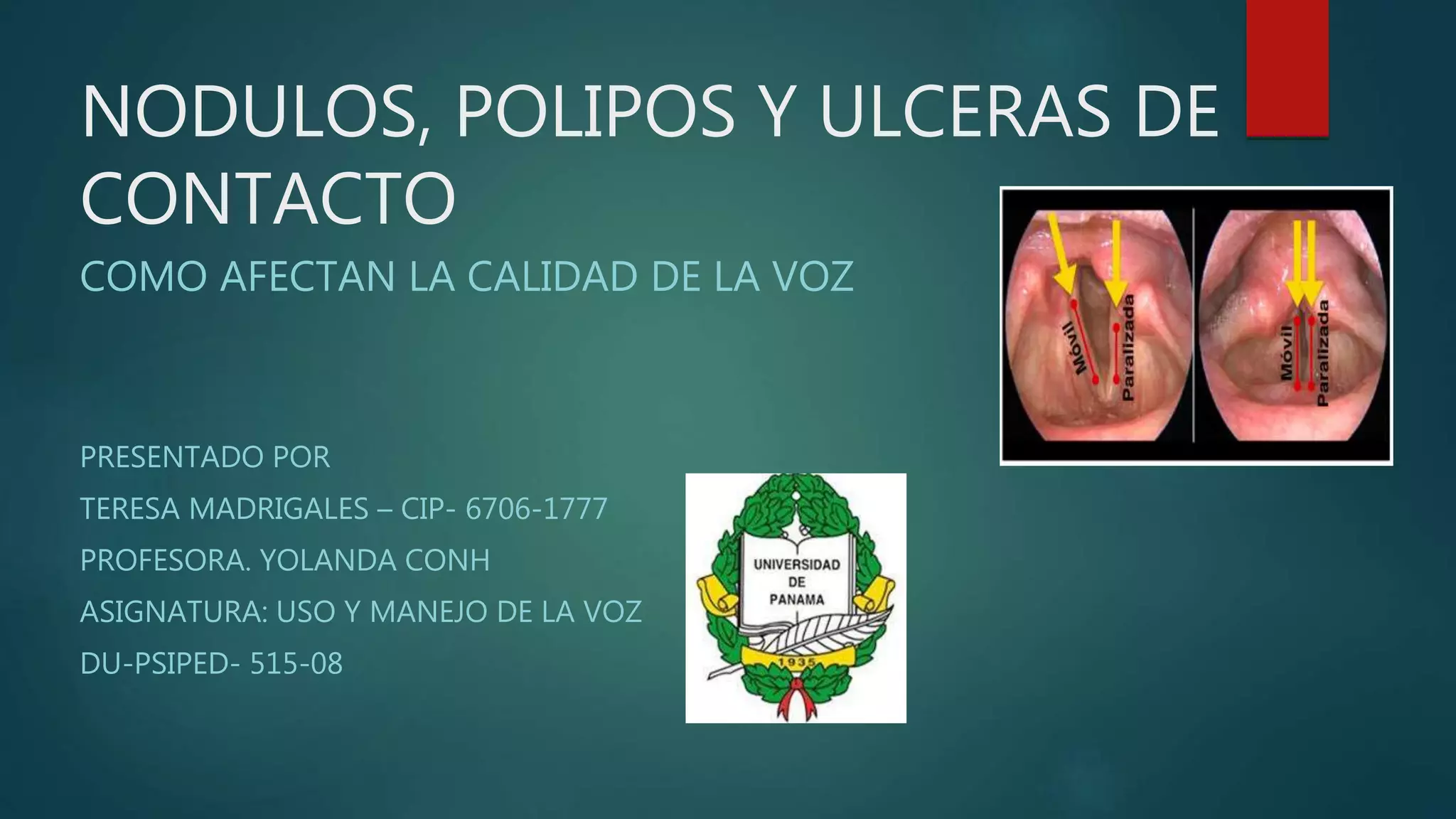 Nodulos, polipos y ulceras de contacto | PPTX