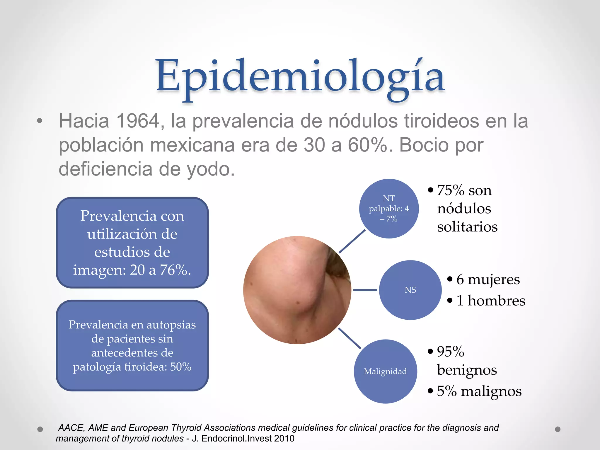 Nódulo tiroideo | PPTX