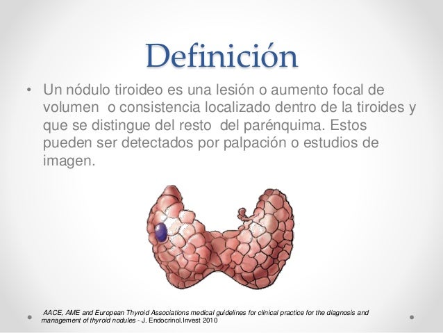 Nódulo tiroideo