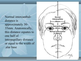 Naso-Orbital-Ethmoidal Fractures | PPT