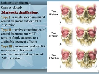 Naso-Orbital-Ethmoidal Fractures | PPT