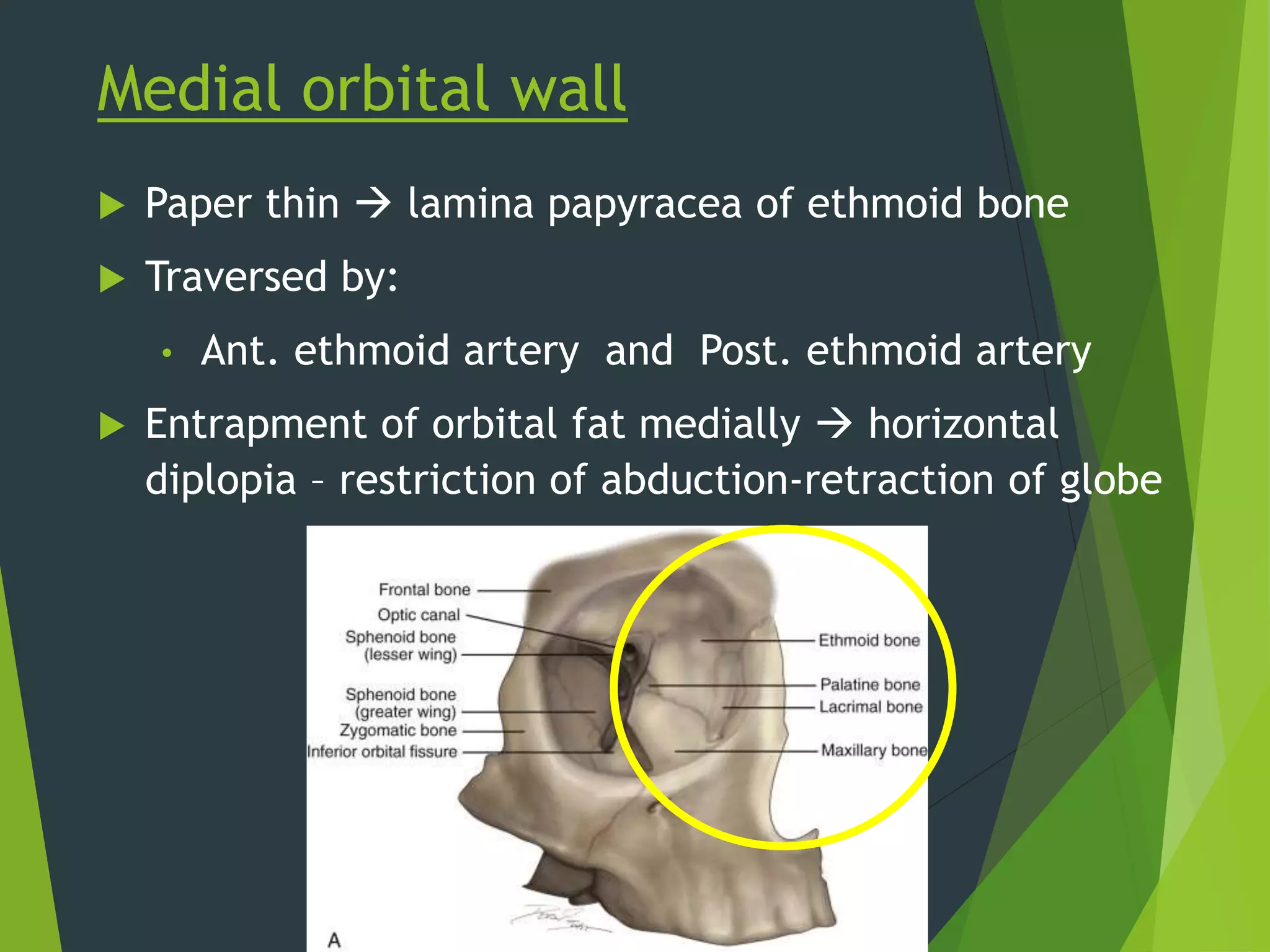 Naso-orbito-ethmoidal fracture | PPTX