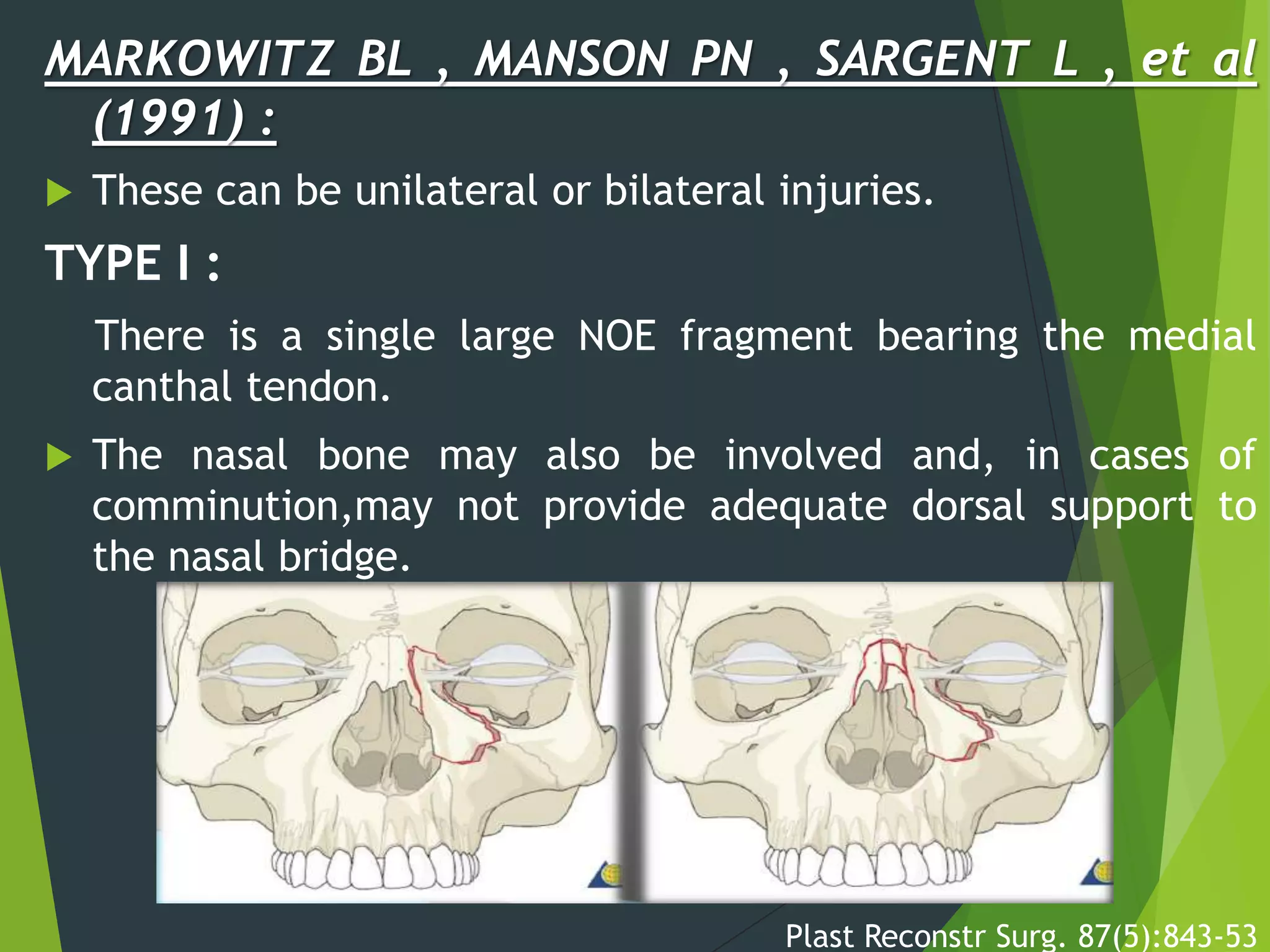 Naso-orbito-ethmoidal fracture | PPTX