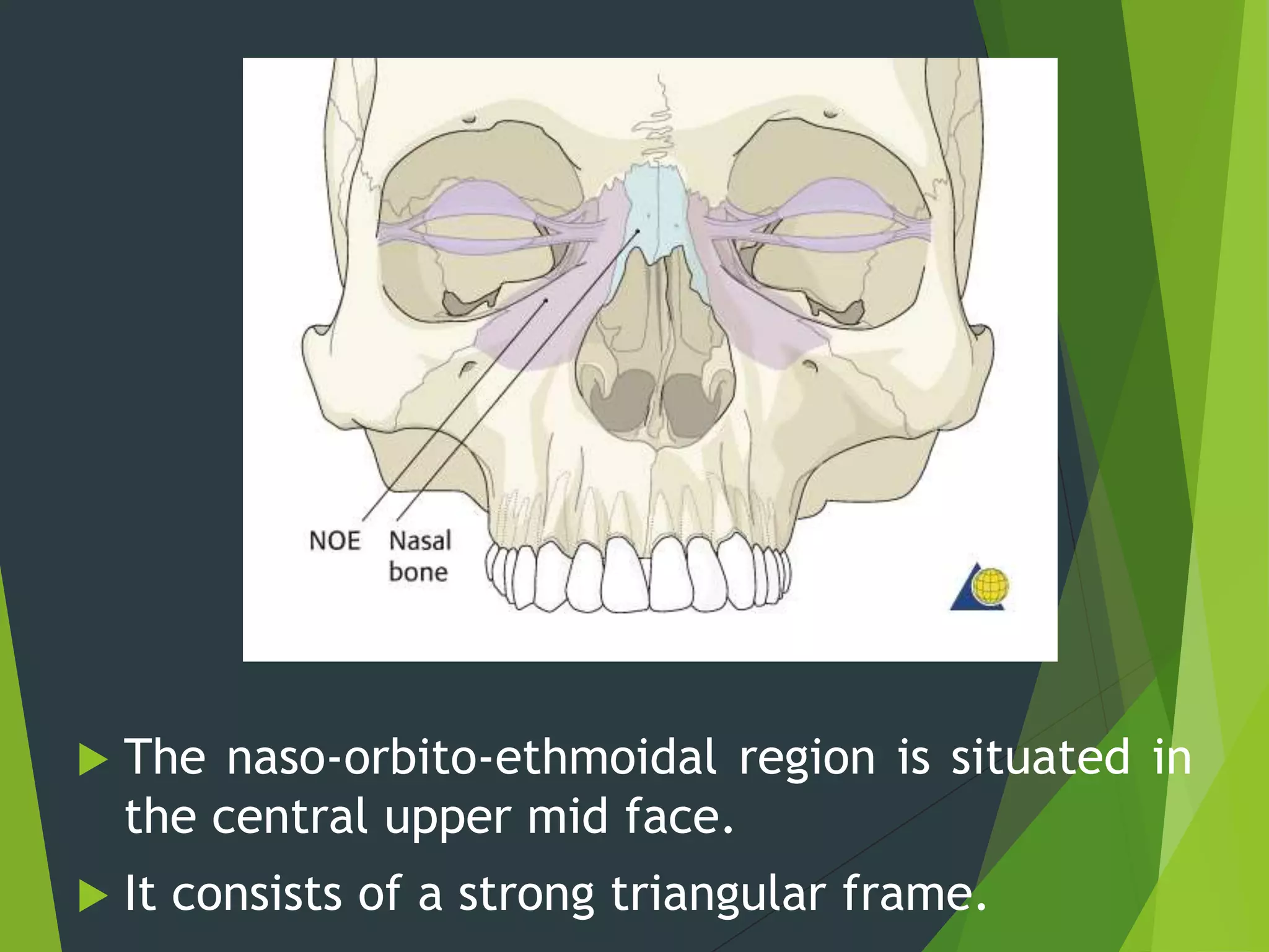 Naso-orbito-ethmoidal fracture | PPTX