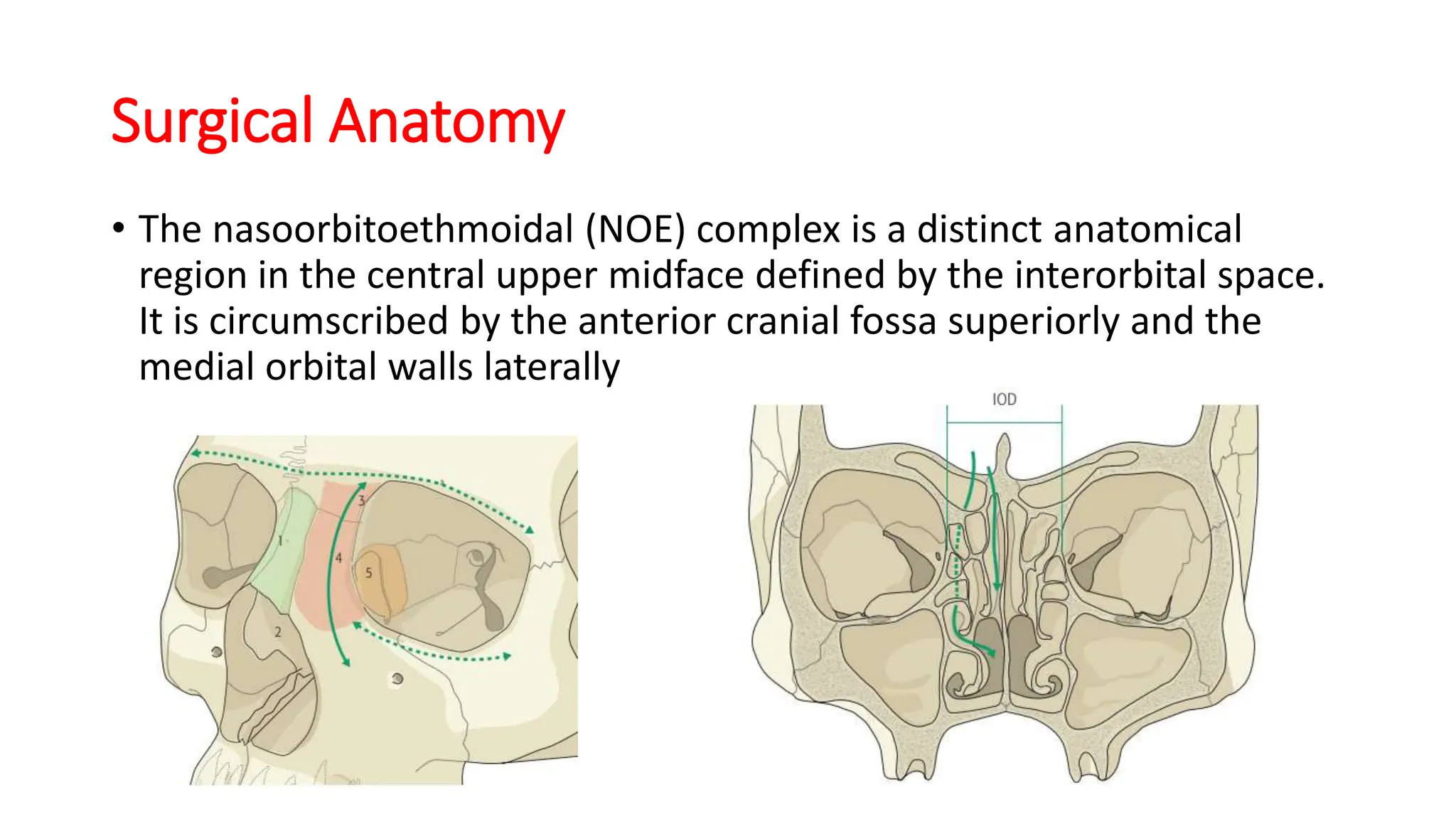 NOE fracture.pptx