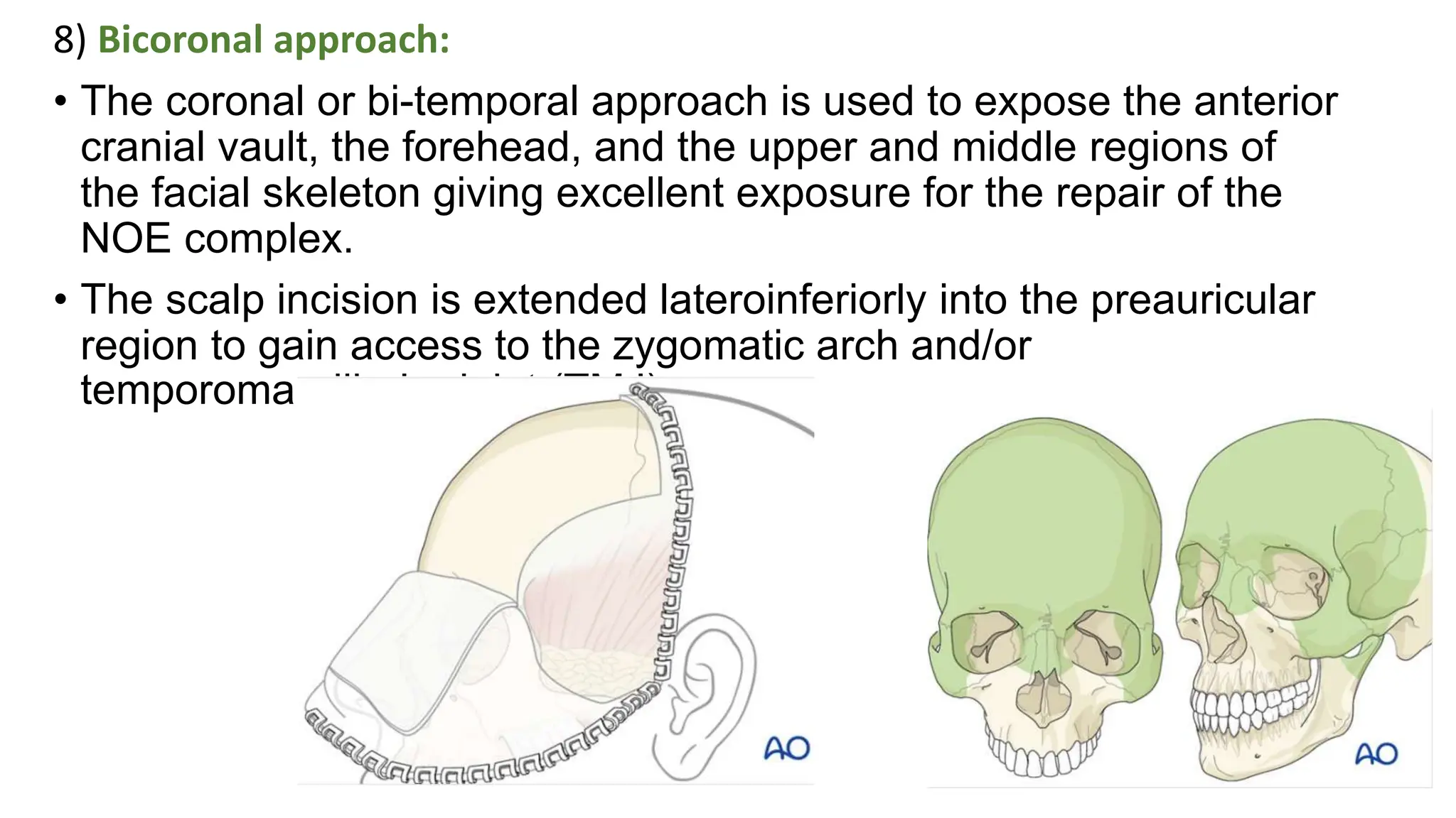 NOE fracture.pptx