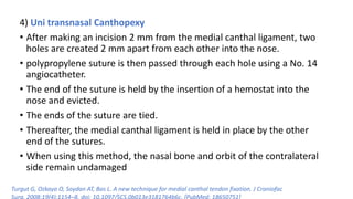 NOE fracture.pptx