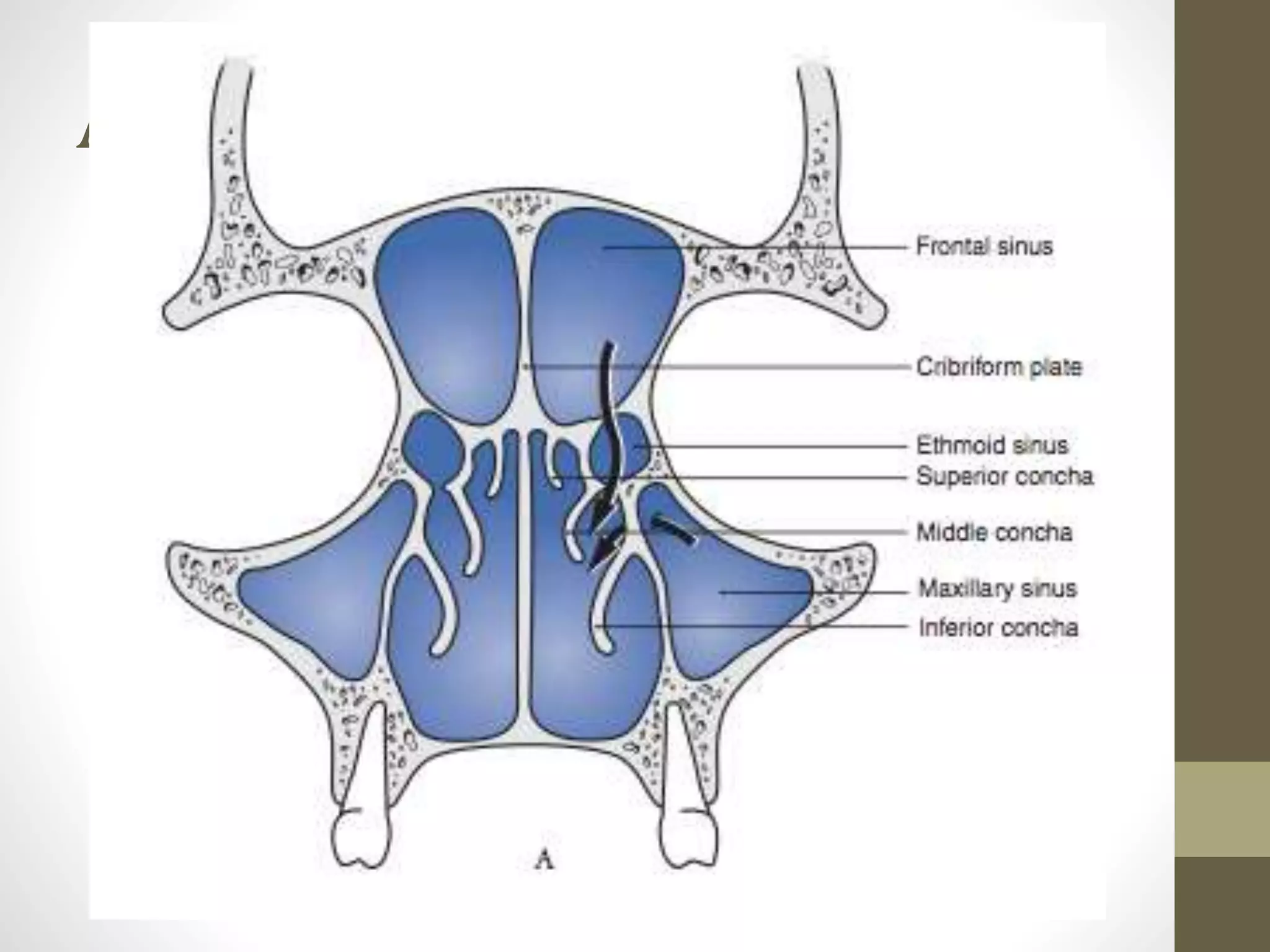 NOE fractures | PPTX