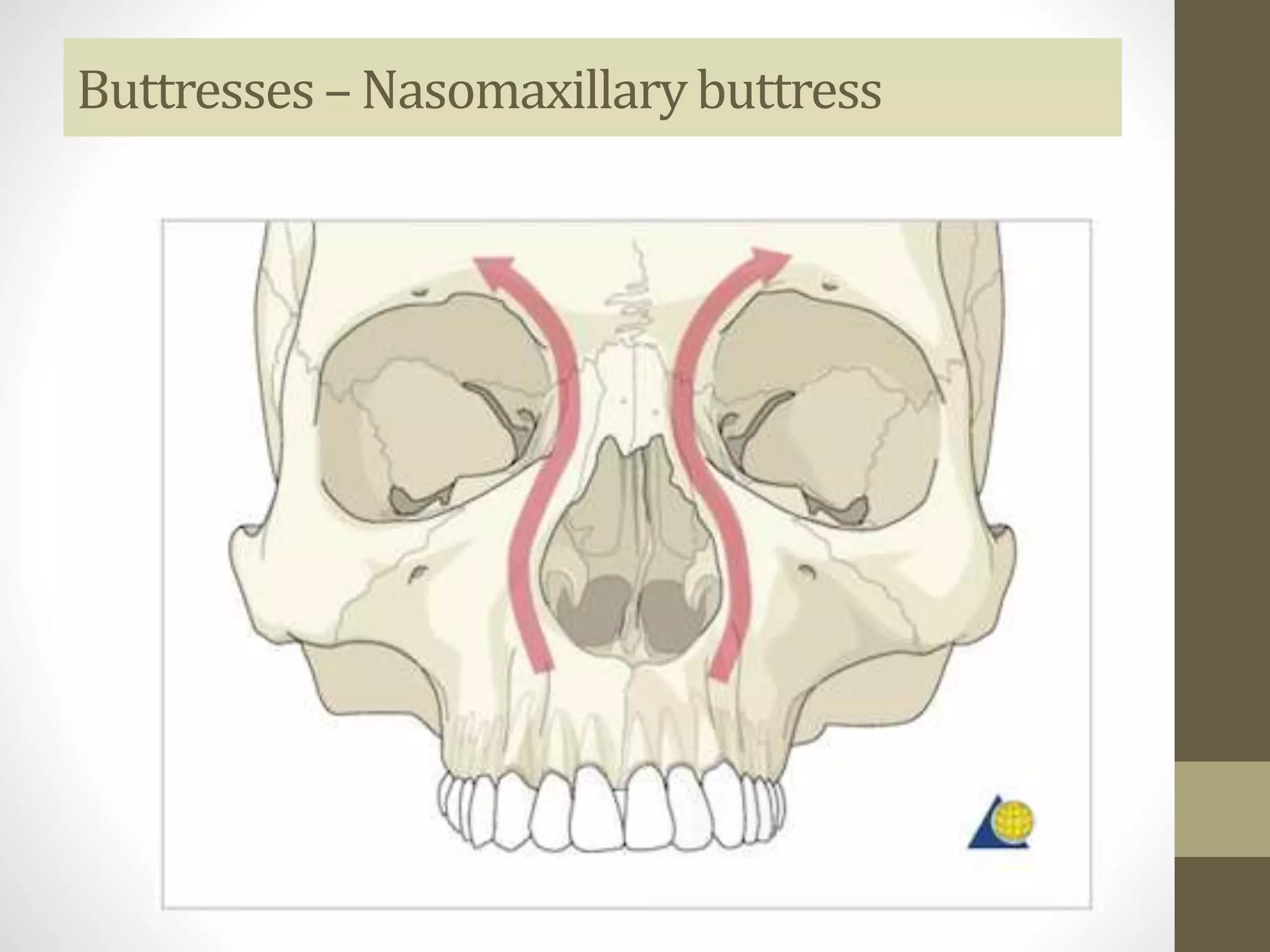 NOE fractures | PPTX