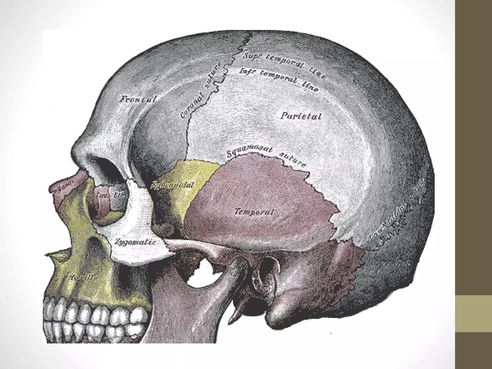 NOE fractures | PPTX