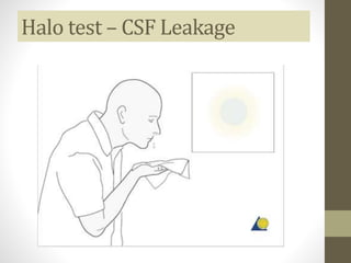 NOE fractures | PPTX