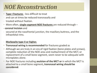 NOE fractures | PPTX