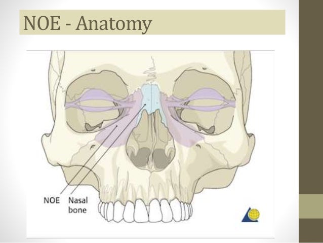 NOE fractures