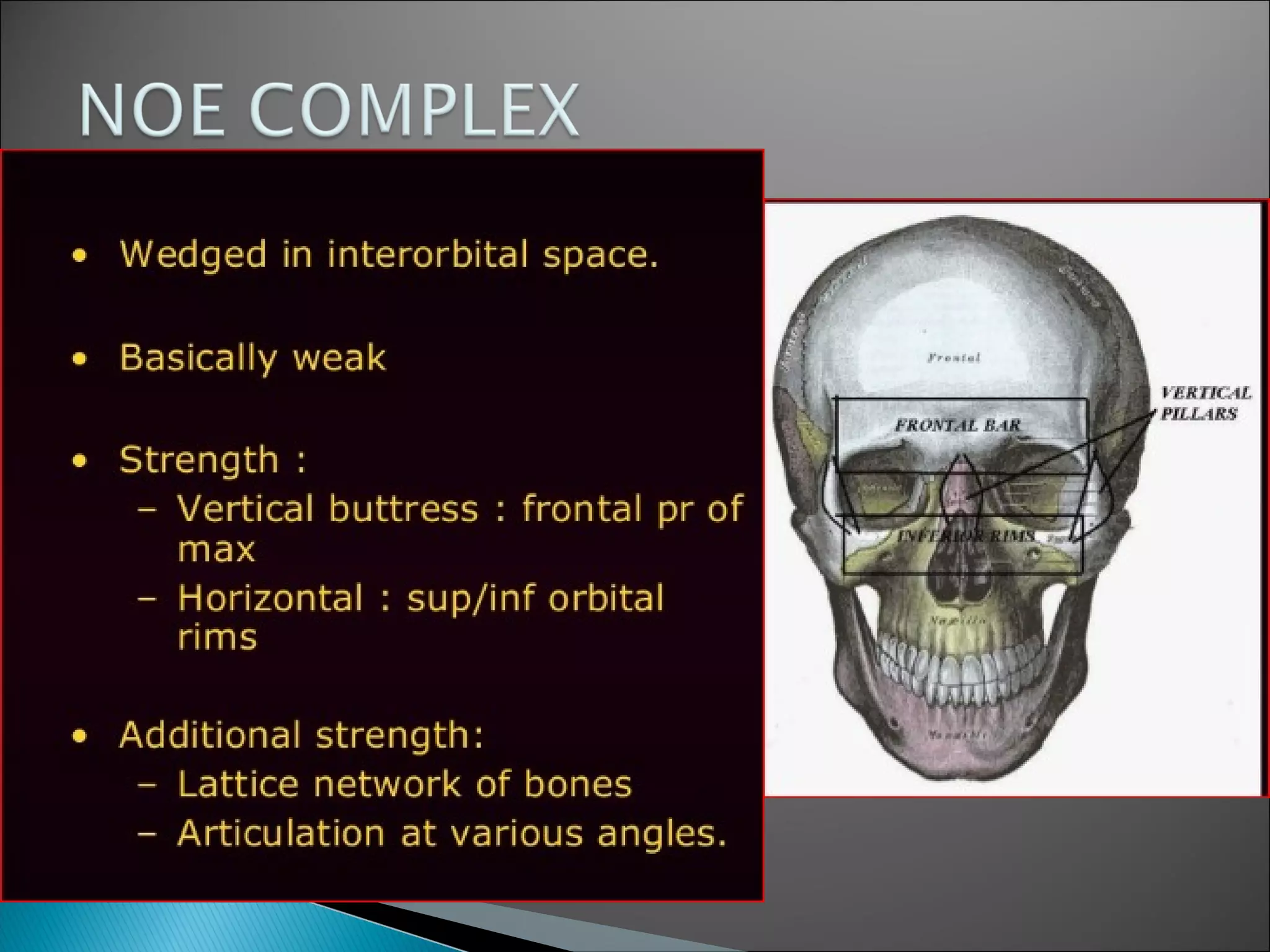 NASO-ORBITO-ETHMOIDAL fracture and management | PPT