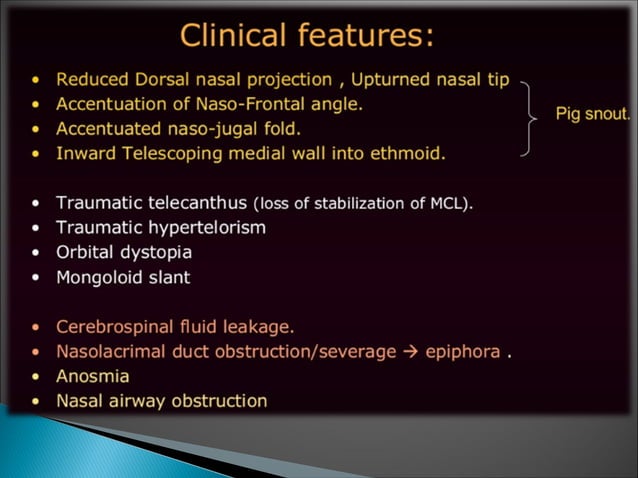 NASO-ORBITO-ETHMOIDAL fracture and management | PPT | Death, Injury, or ...