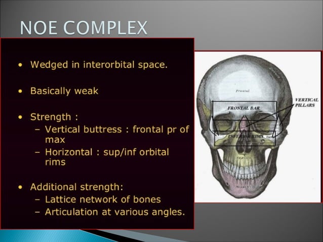 NASO-ORBITO-ETHMOIDAL fracture and management | PPT | Death, Injury, or ...