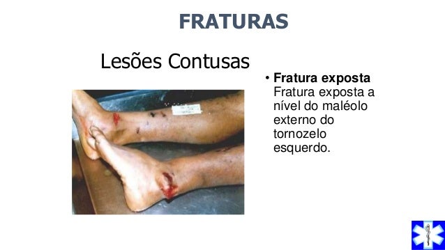 Noções básicas sobre primeiros socorros