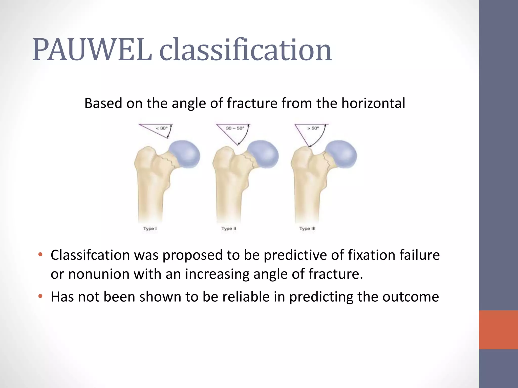 neck of femur fracture | PPTX