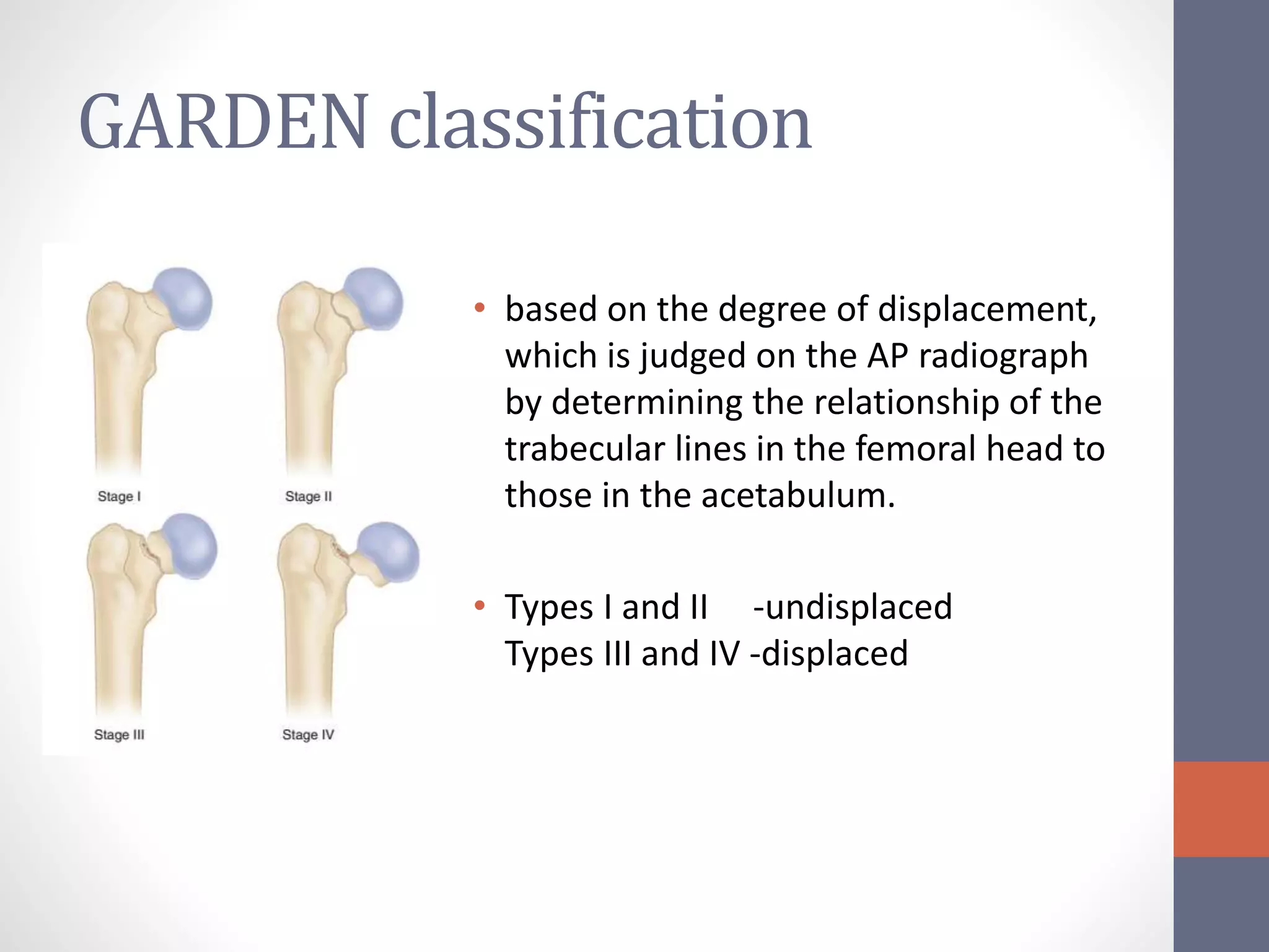 neck of femur fracture | PPTX