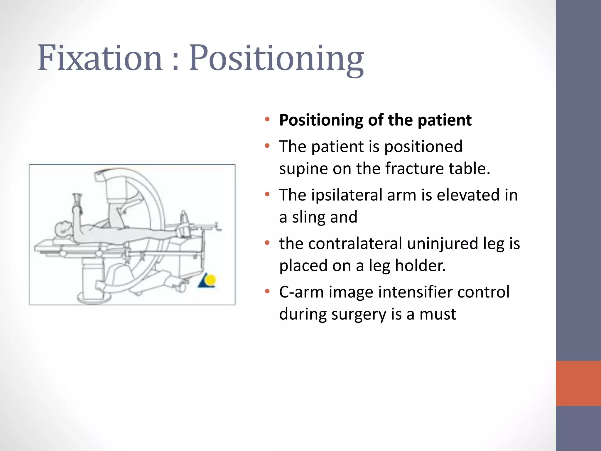 neck of femur fracture | PPTX