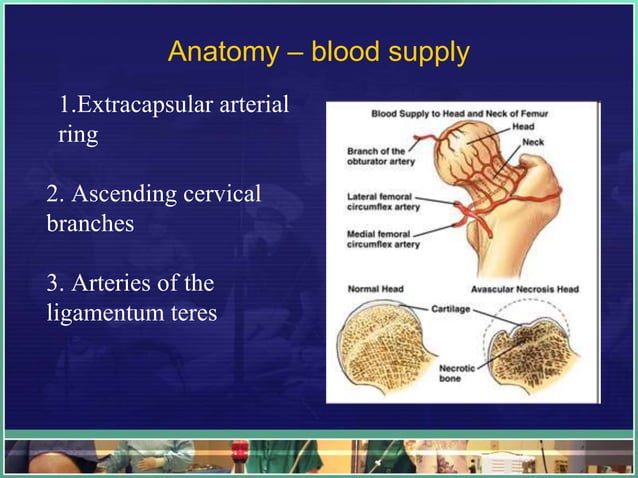 Femoral neck fractures | PPTX