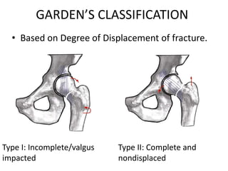 Nof # final (1) | PPTX | Death, Injury, or Military Conflict ...